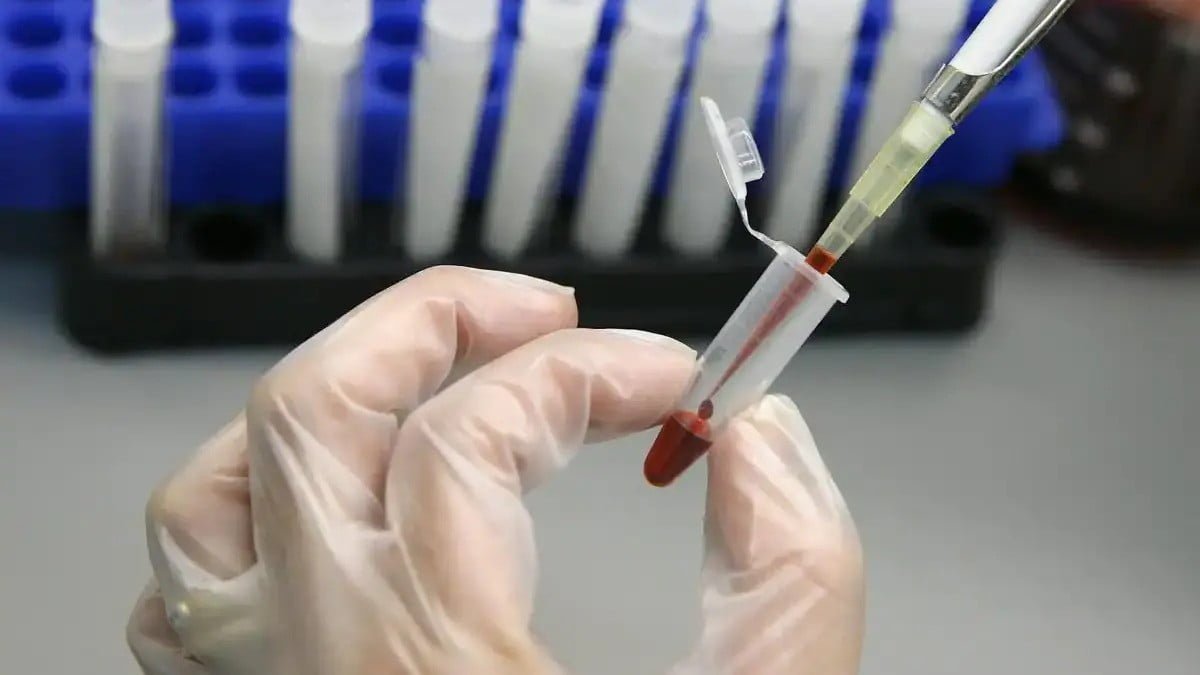 Care este diferența dintre feritină și sideremie?