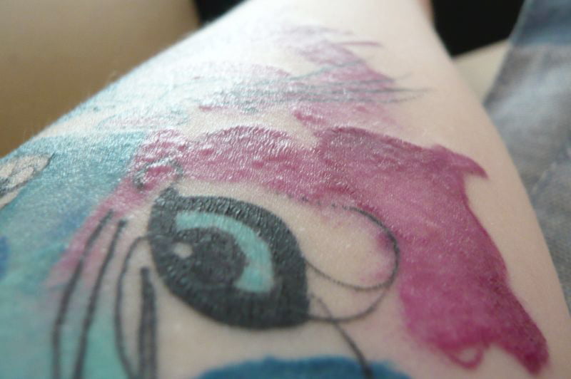 De ce apar bubițe roșii și acnee (puncte albe, comedoane și coșuri) pe ...